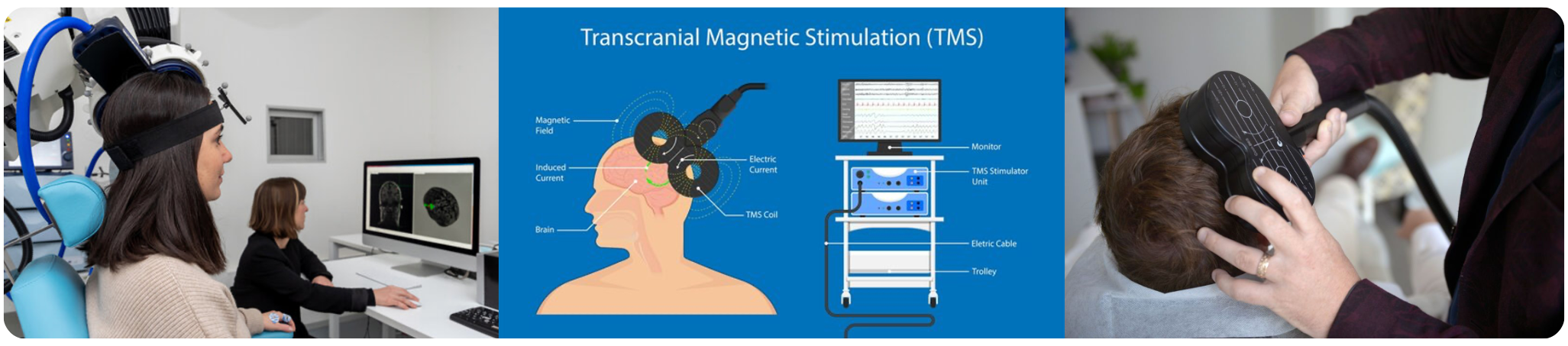 Transcranial Magnetic Simulation (TMS) – NeuroPath Clinic
